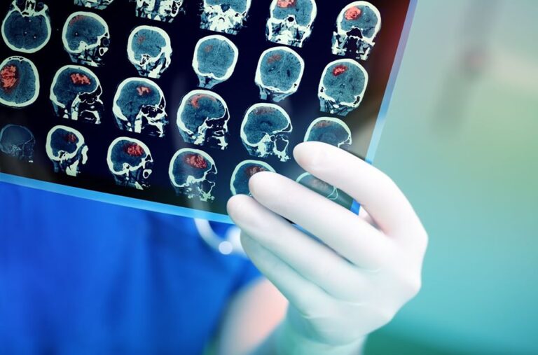 Types of Types of Primary Brain Tumors - Premier Oncology Consultant