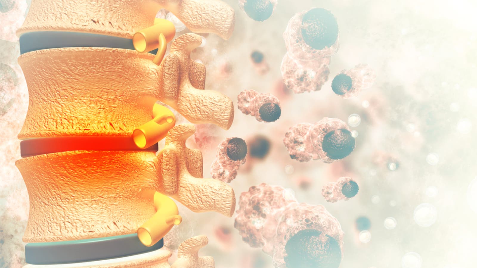 What Are The Different Types Of Bone Cancer Premier Oncology What Are The Different Types Of Bone Cancer Premier Oncology